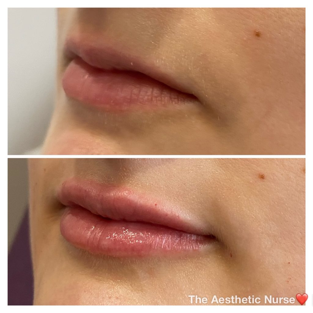 Photo Gallery - The Aesthetic Nurse